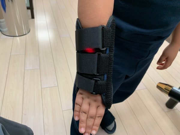 How to Speed Up the Healing of a Buckle Fracture - The Elite Trainer
